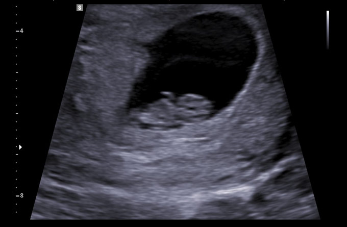 4D Baby Scans from 14 Weeks – Baby Scantastic